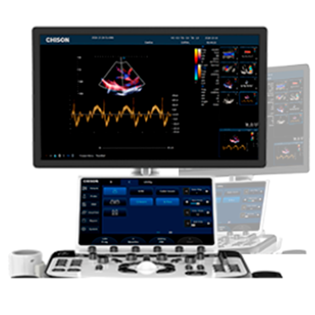 Sistema de Ultrasonido Estacionario CBit 10 – SITECSA